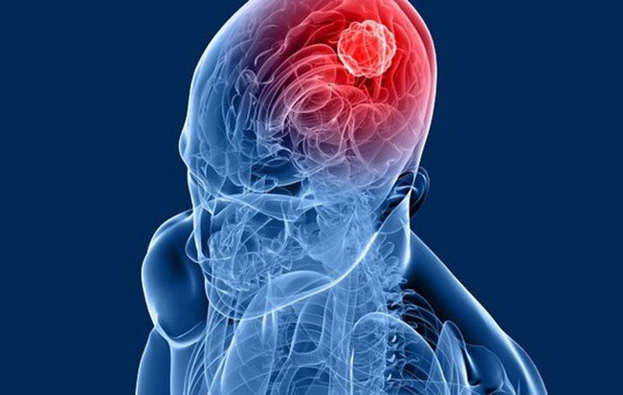 Tumoret zbresin në moshat e reja, rritet mbi 100% fataliteti në femrat ...